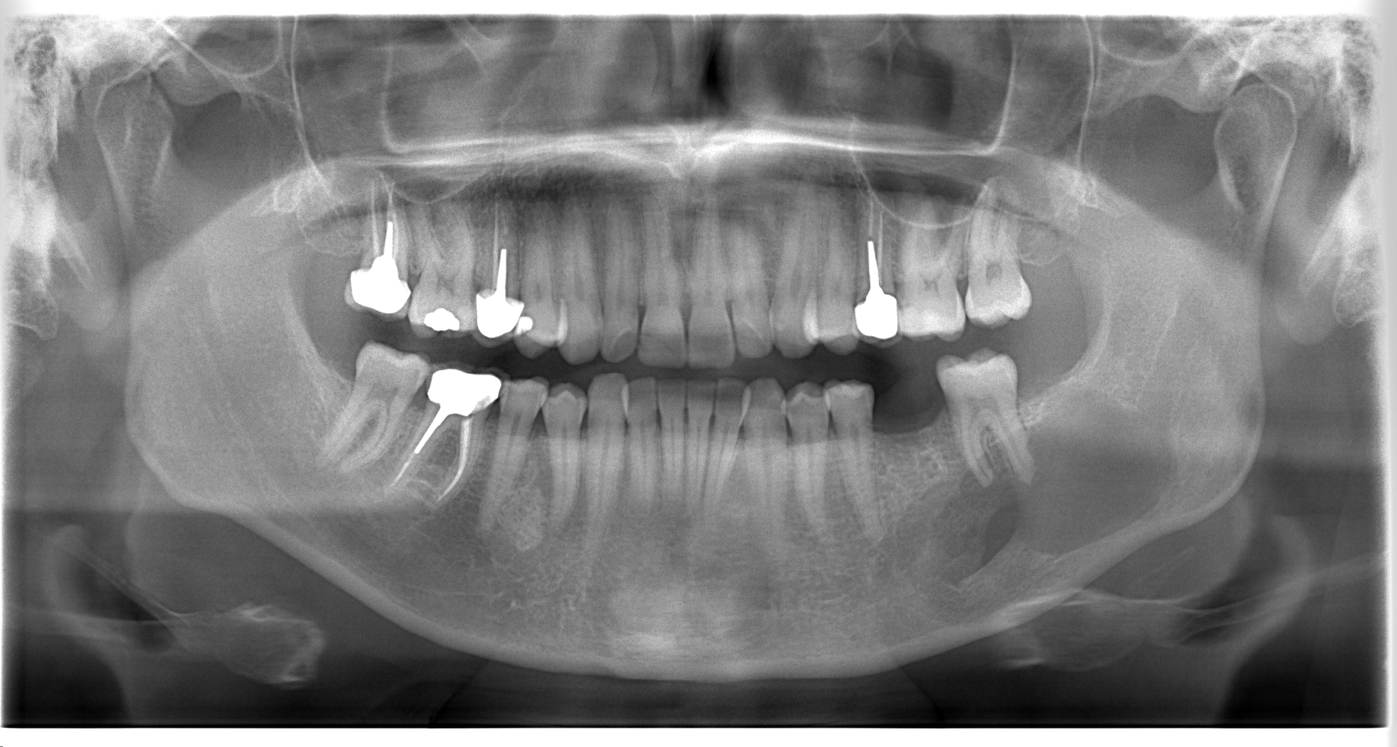 A.E.U - Radio-Anatomie Dento-Maxillaire - Faculté de Chirurgie Dentaire ...